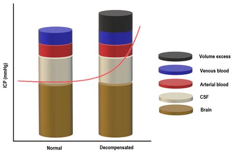 Optic Nerve Sheath Diameter