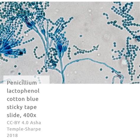 Penicillium Under Microscope 400x
