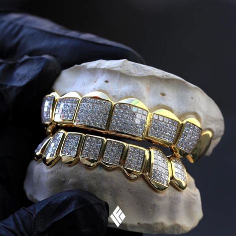 Grill Diamond Set At Thelma Guerrero Blog