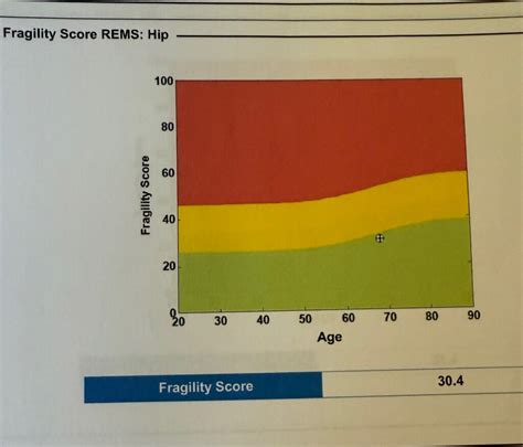 The Future Of Bone Health Understanding Bone Strength And Bone