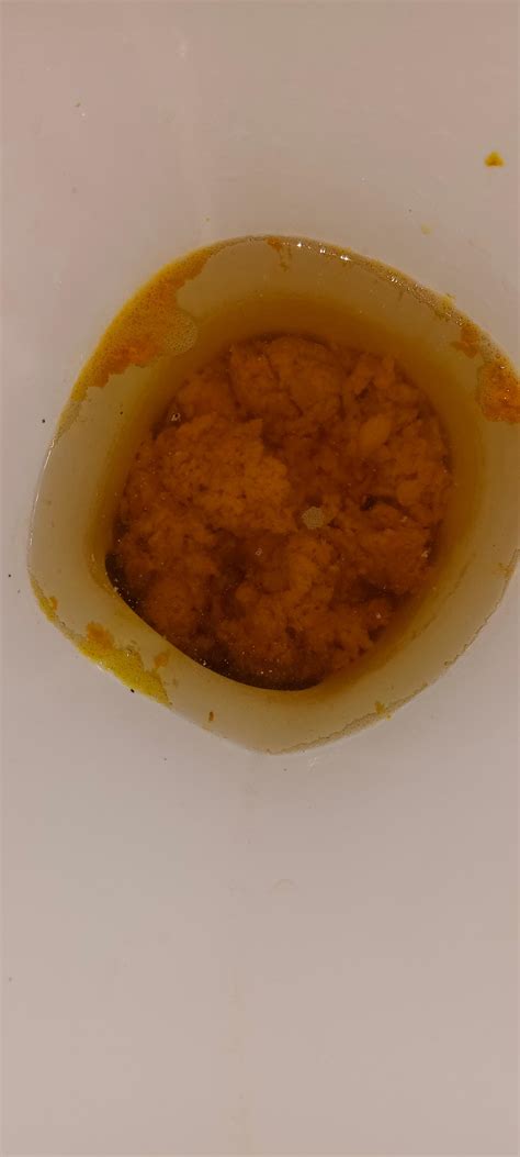 Orange Mucus In Stool Ibs