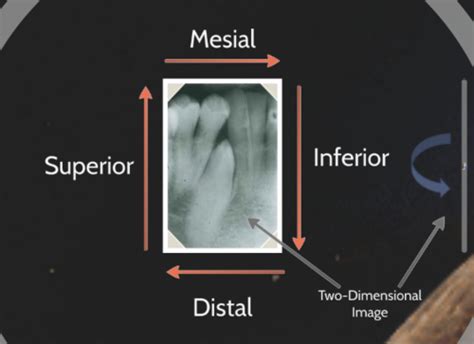 Object Localization Flashcards Quizlet