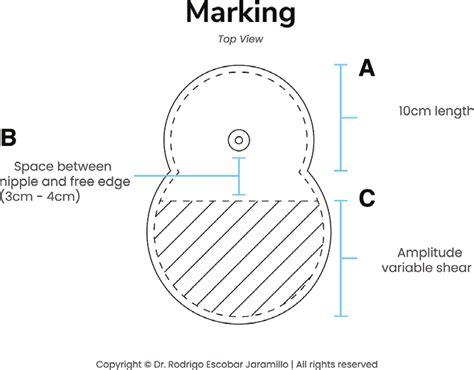 Marking Technique An Observed Discrepancy In The Proportion Of Skin Download Scientific