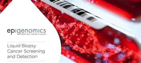 Manda New Day Diagnostics To Acquire The Assets Of Epigenomics Ag