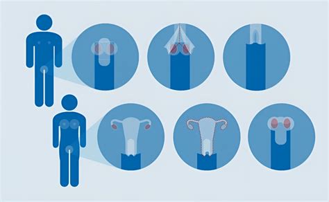Intersex Là Gì Những Thông Tin Về Intersex Mà Bạn Cần Biết