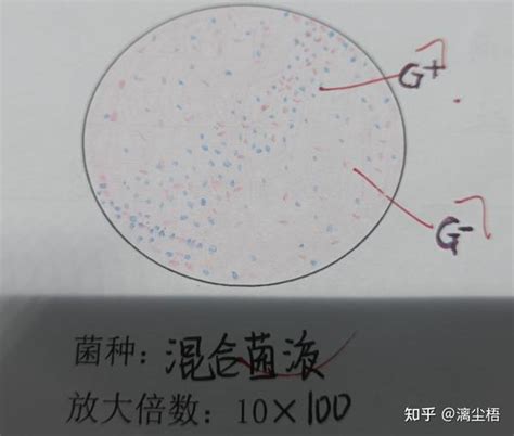 医学微生物学——第一次实验报告 知乎 医学微生物学——第一次实验报告 知乎