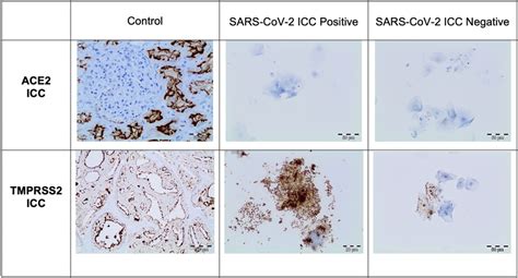 Cases Under Investigation For Sars Cov 2 Infection Involving
