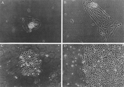 Pattern Of Endothelial Cell Growth From Isolated Human Glomeruli A