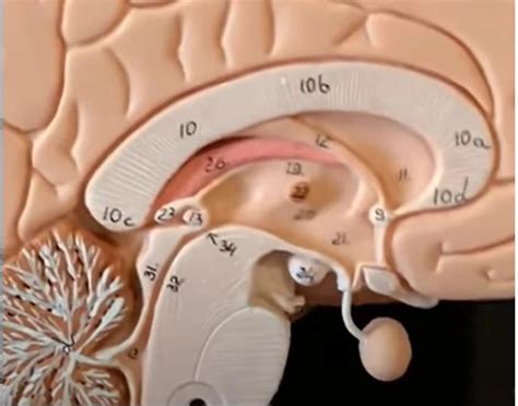 Anatomy Of The Diencephalon Of The Human Brain Quiz
