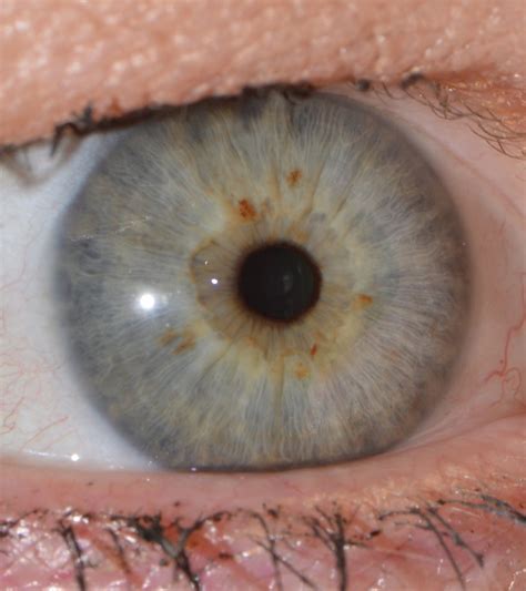 The Psychic Eye Irigenics