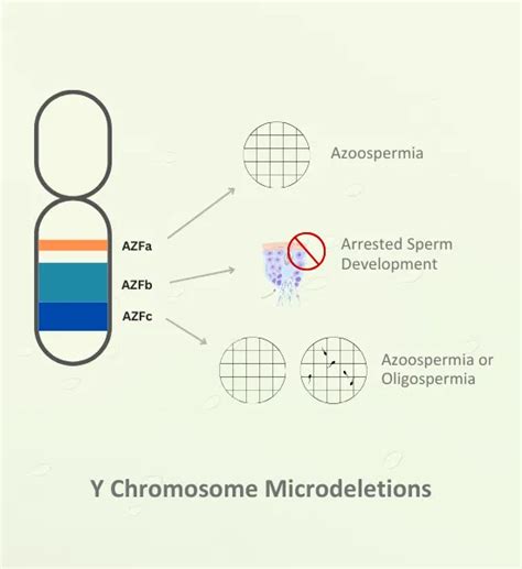 Y Chromosome Sperm Y Chromosome Wikipedia