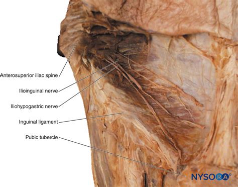 Suprascapular Nerve Cadaver