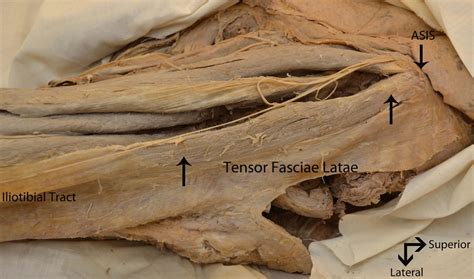 Tutoplast Fascia Lata