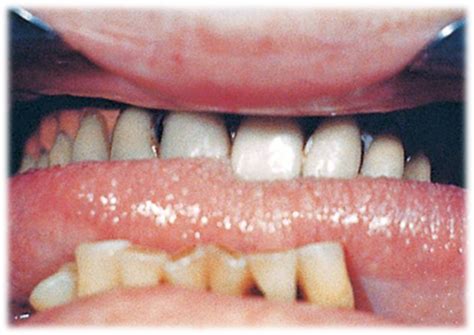 Op Ch 9 Flashcards Quizlet