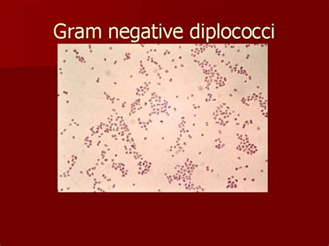 Meningitis The Basics Steven M Snodgrass M D