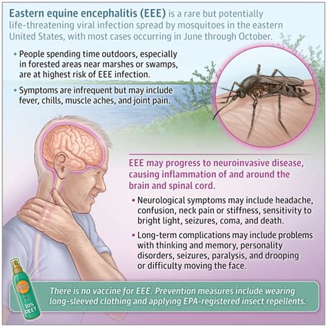 Eastern Equine Encephalitis Eee Is A Potentially Life Threatening
