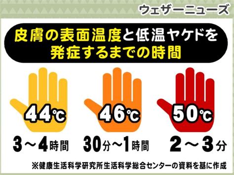 低温やけどの画像 低温やけど 医療用語 Naslemm