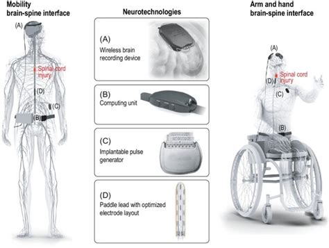 Brainspine Interfaces To Reverse Paralysis Pmc