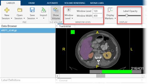 Segment CT Scan Using MONAI Label MATLAB Simulink