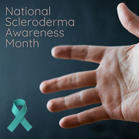 🌟 June Is National Scleroderma Awareness Month 🌟 This Rare Autoimmune Disease Affects The Skin