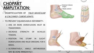 Amputations Of Foot And Its Rehabilitation Pptx