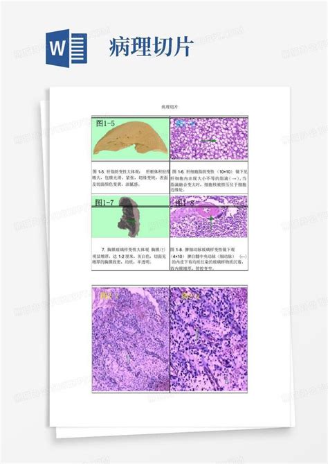 病理切片word模板下载 编号ldxwaggk 熊猫办公