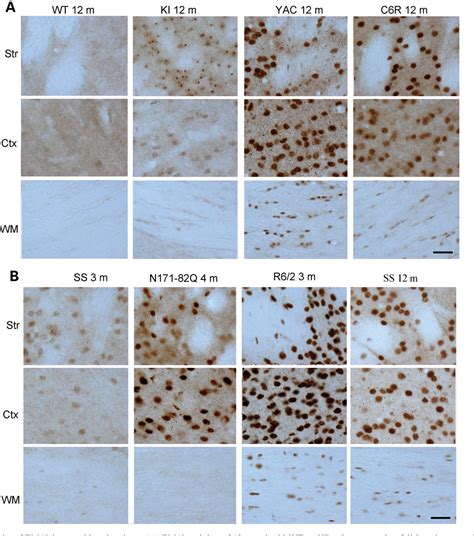 Figure 3 From Accumulation Of N Terminal Mutant Huntingtin In Mouse And