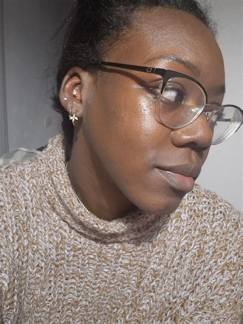 Almost 3 Weeks With Tretinoin R Tretinoin