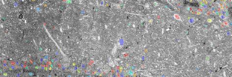 Hard X Ray Imaging Of Biological Soft Tissues Symposium 2023 Crick