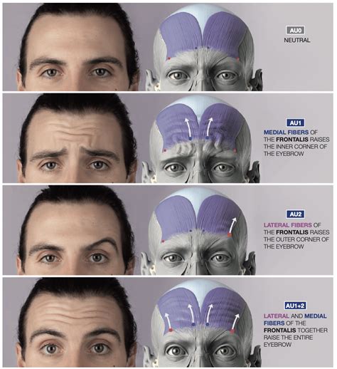 Understanding The Forehead Muscles Preventing Brow Droop