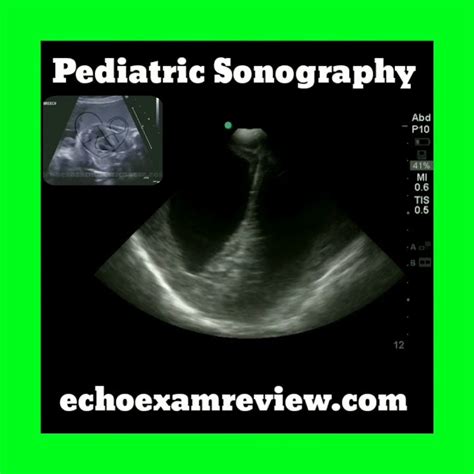 Pediatric Sonography Youtube