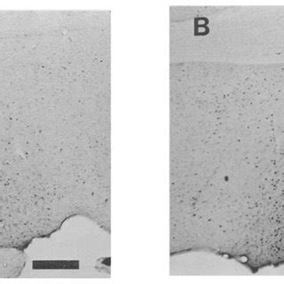 Sex Differences In Immunostaining Intensities Photomicrographs Of Download Scientific Diagram