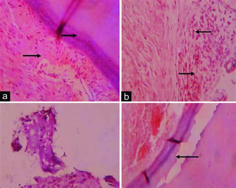 Histological Photomicrograph Of Growth Factor Group A Download