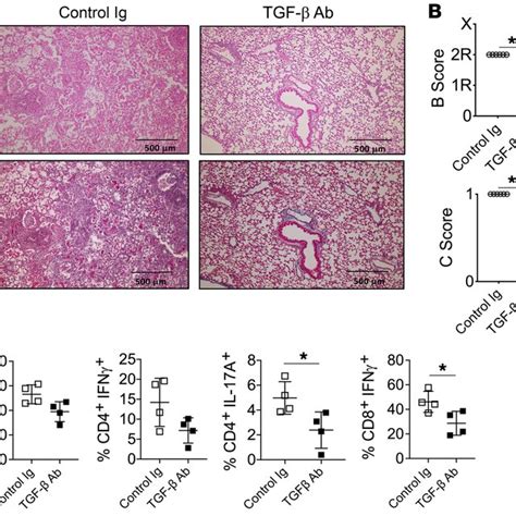 Tgf β Blockade Prevents Intragraft Ifn γ Cd8 T Cell Accumulation