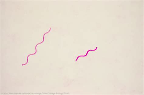 Gram Positive Spirilla