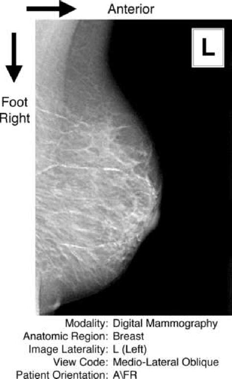 Information Available In A Dicom Dx Image To Help In Hanging Images