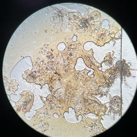 Spider Mites And An Ant Under A Microscope R Entomology