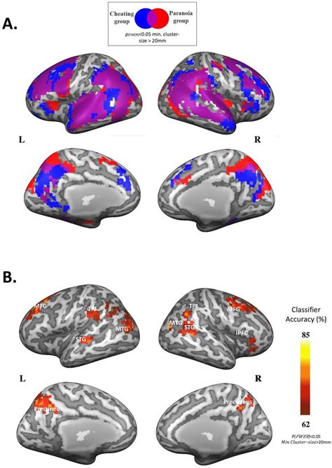 A Cortical Maps Showing Voxels That Are Significantly Encoded Ie
