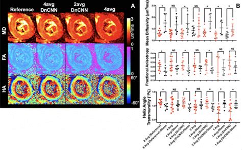 Accelerated In Vivo Cardiac Diffusion Tensor Mri Using Residual Deep