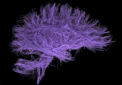 Brainfuck Code That Was Designed To Hurt The Outline