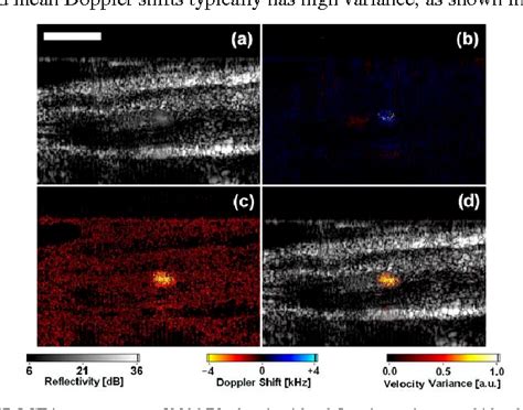 Figure 4 From High Speed Wide Velocity Dynamic Range Doppler Optical Coherence Tomography Part