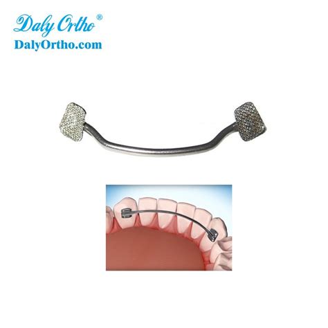 Types Of Wires In Orthodontics At Glen Williams Blog
