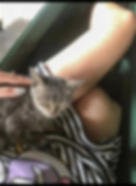 Amputee Stump Video 26