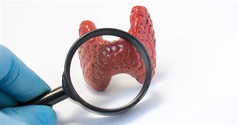 6 Hidden Thyroid Problems That May Surprise You Symptoms And Fixes