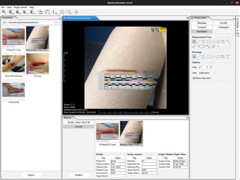 Weasis Dicom Medical Viewer 4 5 1 Image Viewing Software