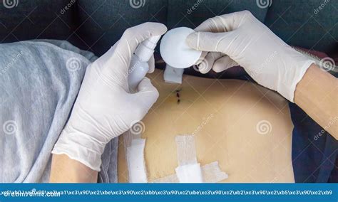 Examination Of The Patient By A Doctor After Removal Of The Appendix Selective Focus Stock Photo