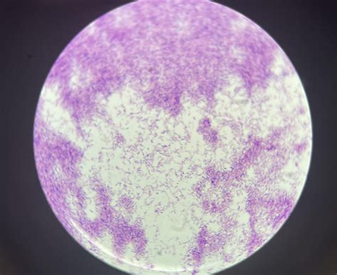 Enterobacter Aerogenes Unknown Bacteria Id Is A Lactose Fermentor And