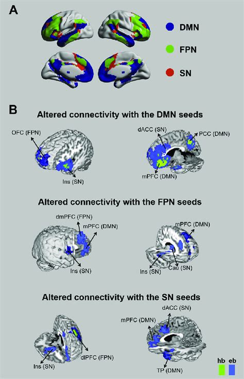 Functional Connectivity Differences Between Psychiatric Disorders And Download Scientific
