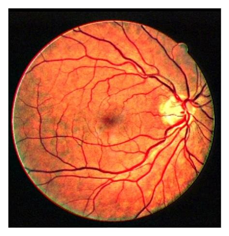 The Enhancement Process Of The Chosen Retinal Image From The Drive Download Scientific Diagram