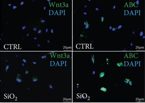 sio2 activates wnt β catenin signaling in lung epithelial beas 2b